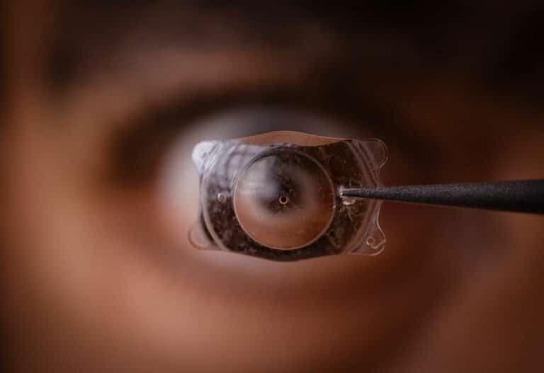 What Is EVO ICL™ Surgery? | Edmonton & Northern Alberta